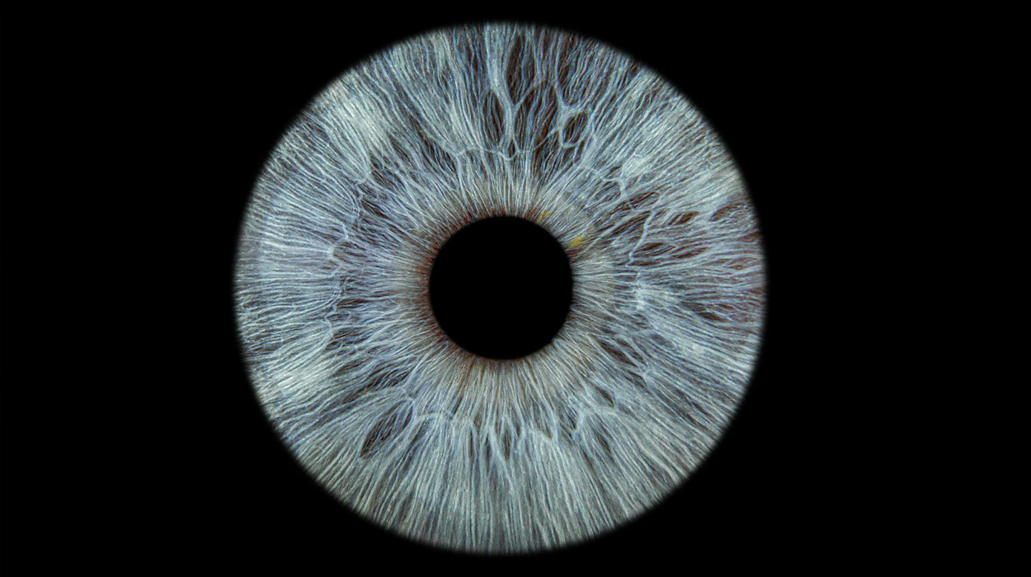 Iron Deficiency and Your Eyes - EuroEyes