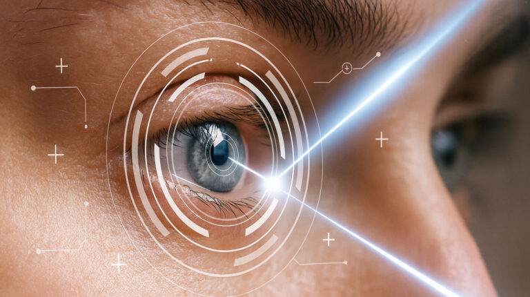 What to Expect During Recovery in the UK After Laser Eye Surgery